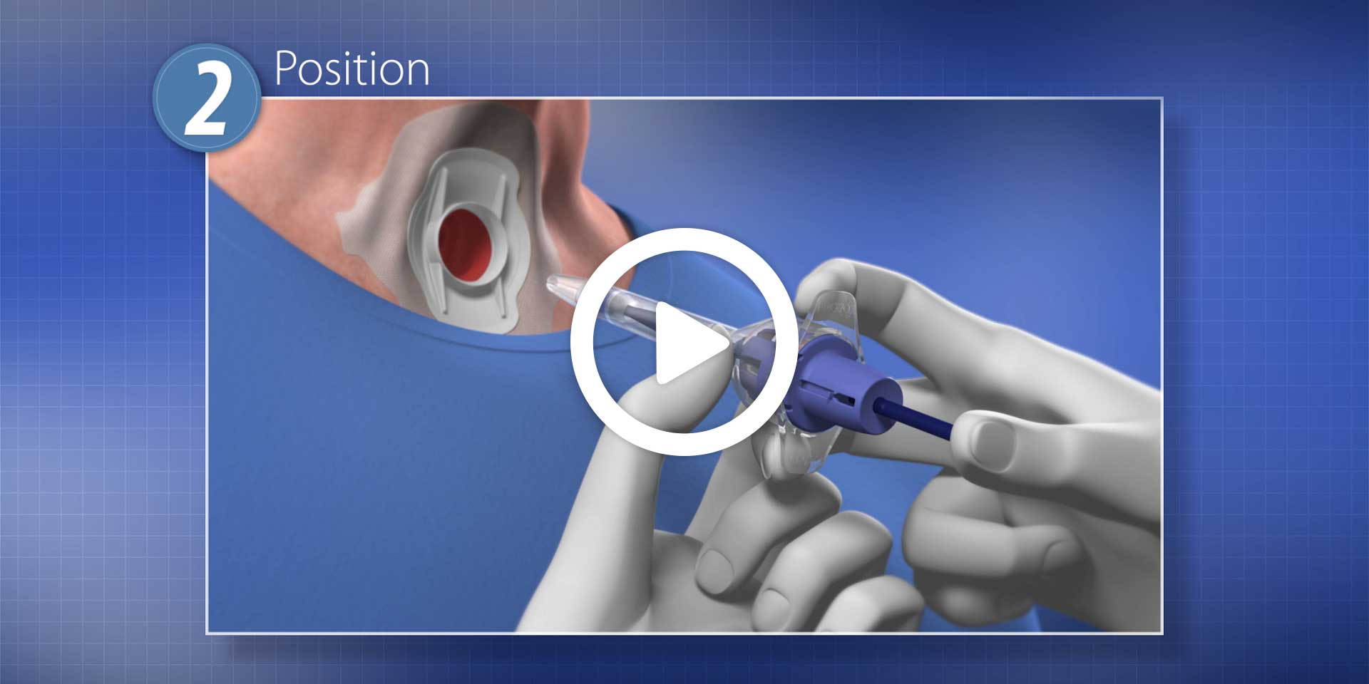 Brief presentation of a smart product